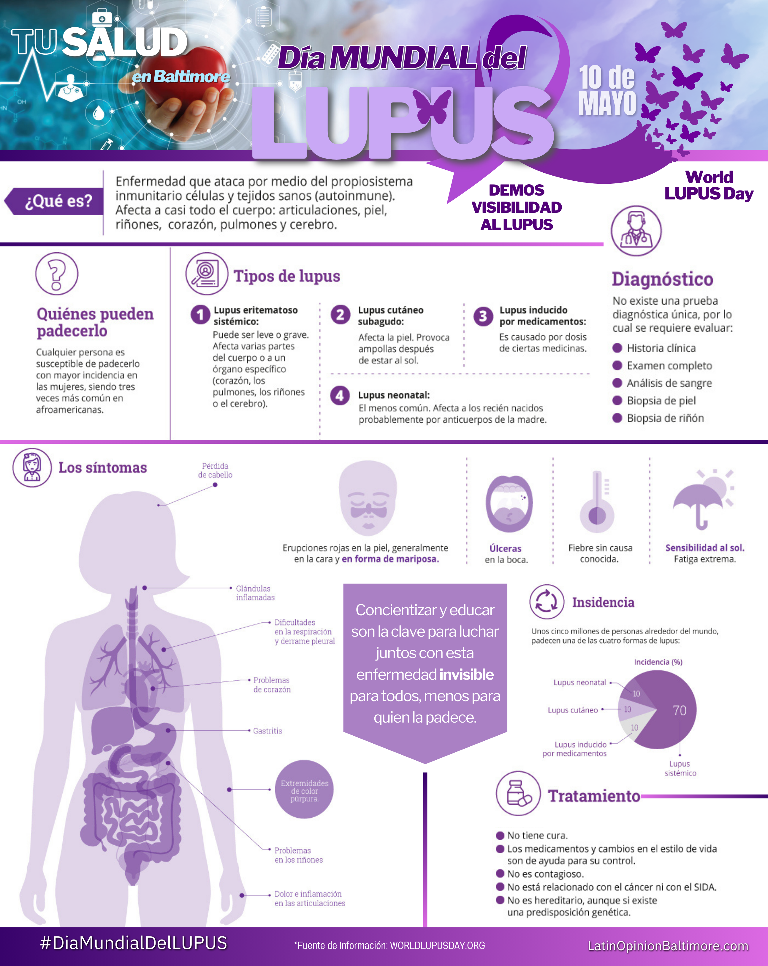 10 de Mayo, Día Mundial del LUPUS - Latin Opinion Baltimore